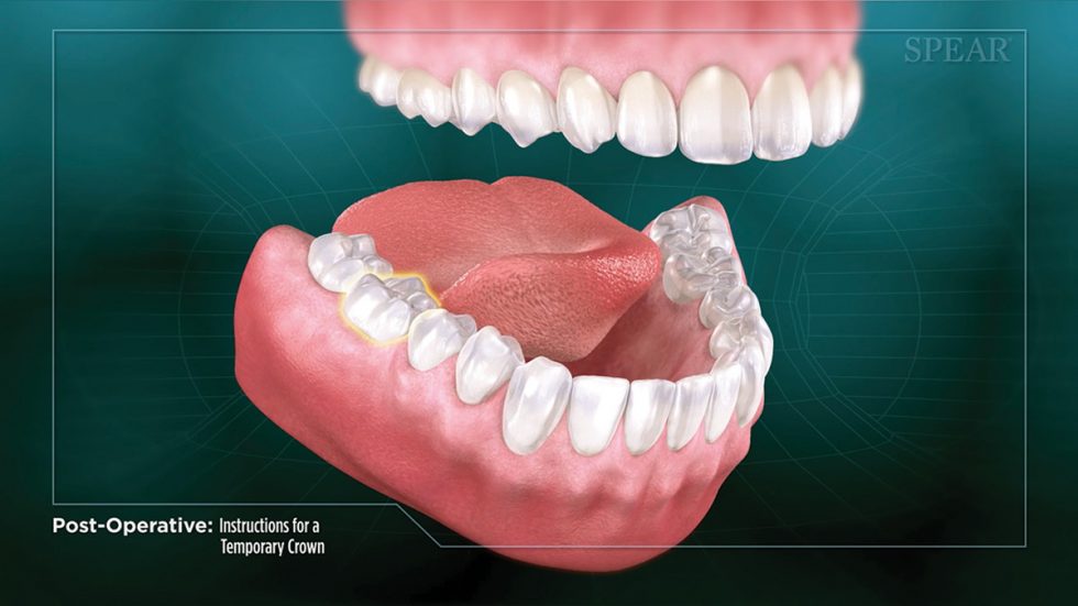 Dental Animations - Gray Creative