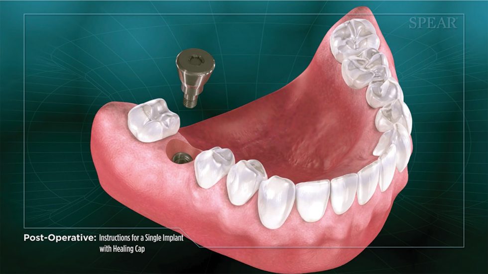 Dental Animations - Gray Creative